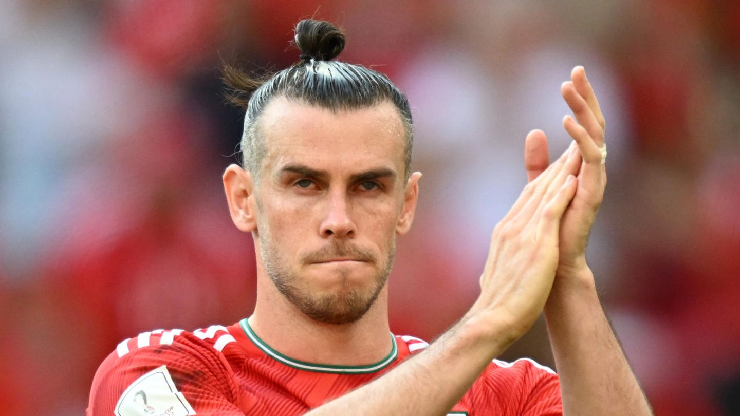 Gareth Bale Hair Transplant - Hermest Clinic
